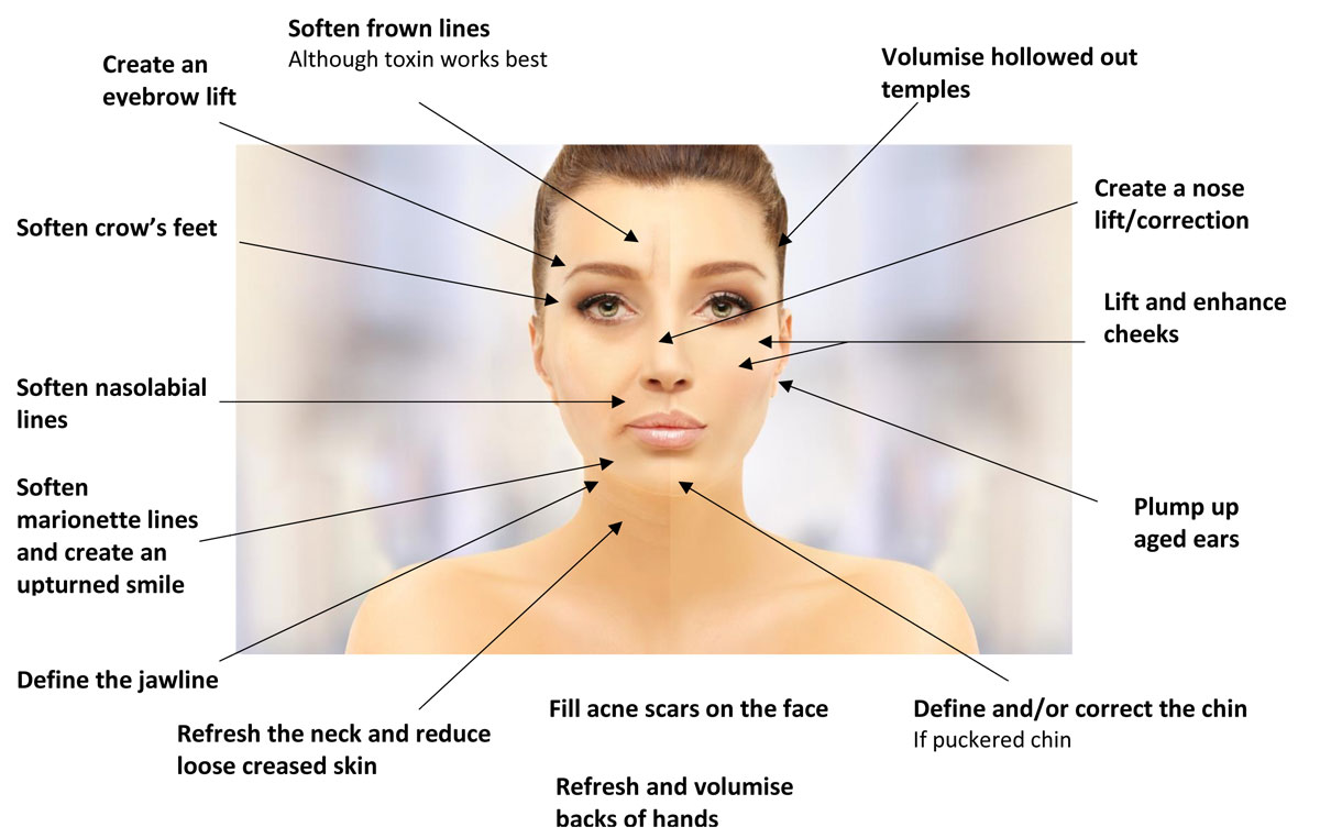 Bio-Stimulators in Wrexham | Collagen Boost